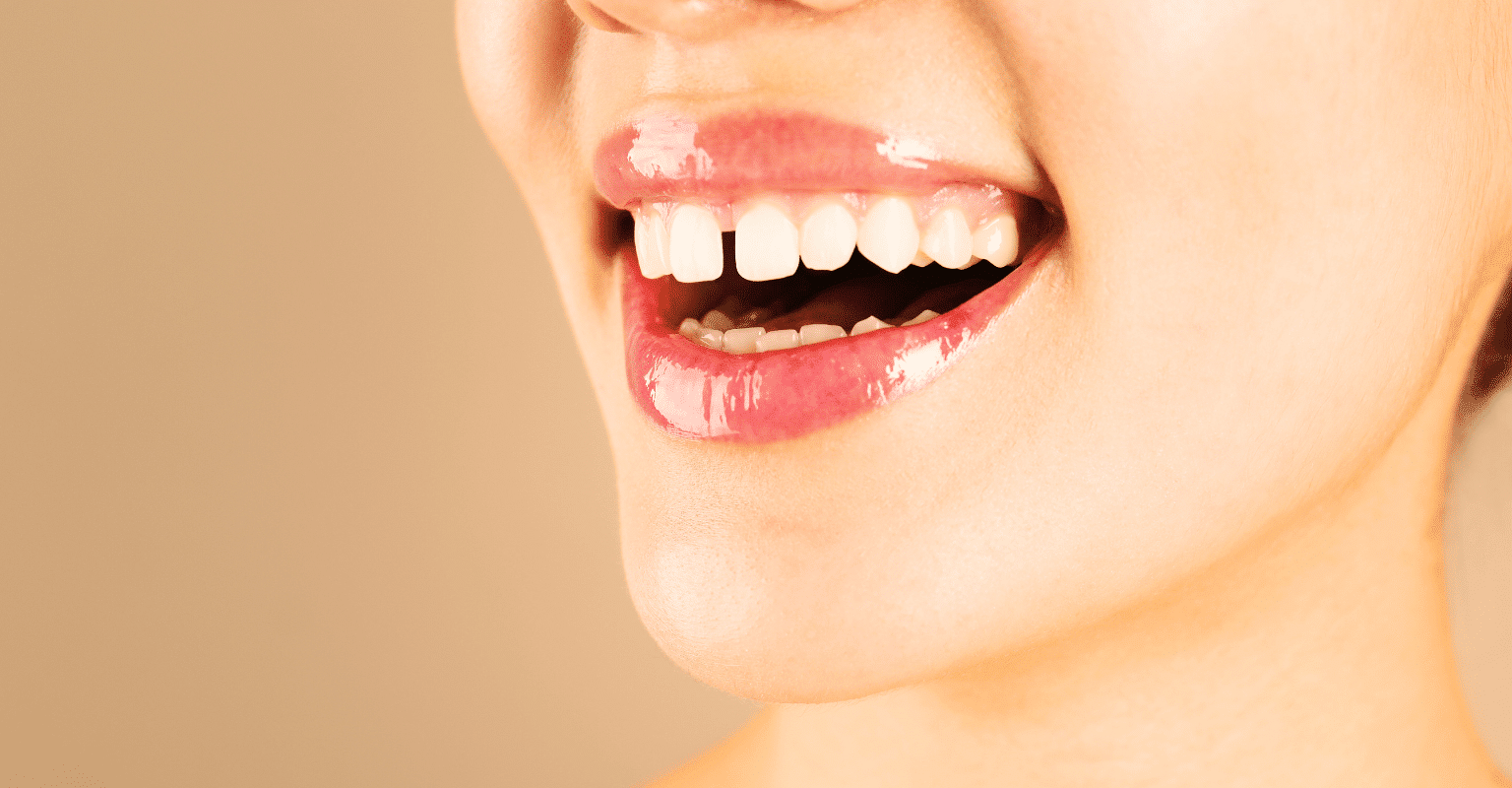 How Do You Know If Your Teeth Are Healthy | Dental Faith