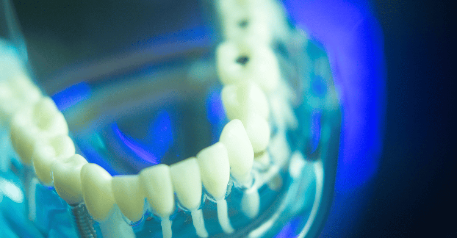 How To Heal Cracked Teeth Naturally | Dental Faith